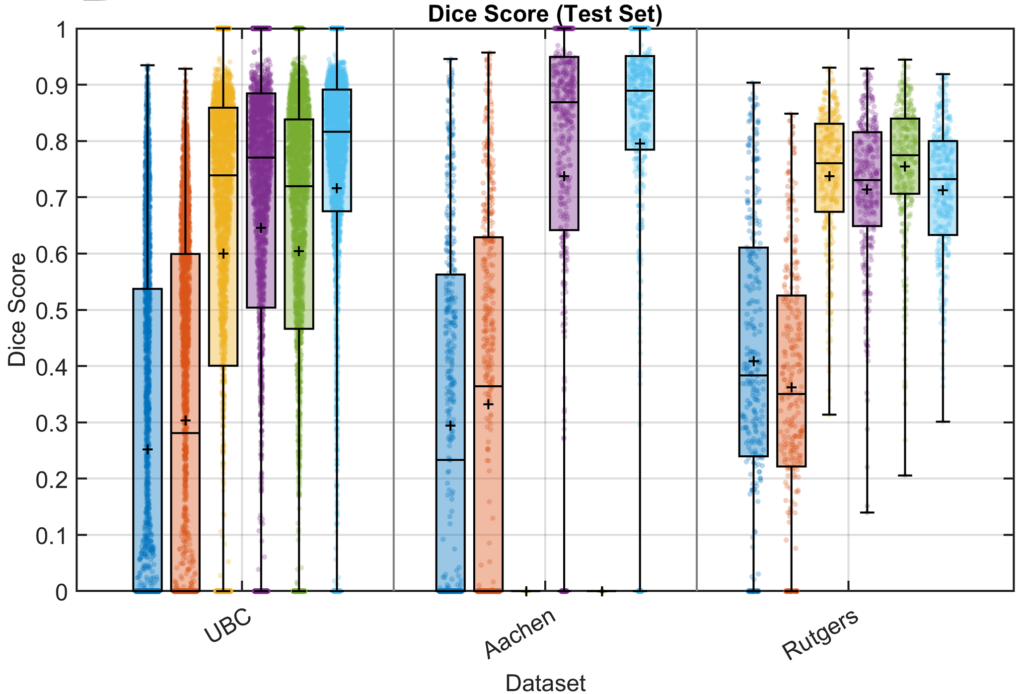 Standardized Evaluation Of Current Ultrasound Bone Segmentation Algorithms On Multiple Datasets